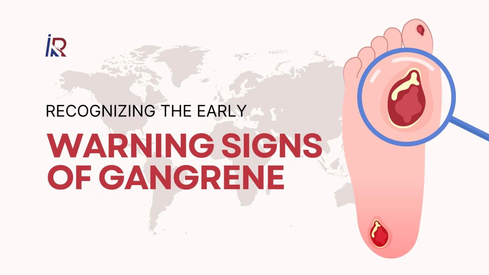 Recognizing the Early Warning Signs of Gangrene
