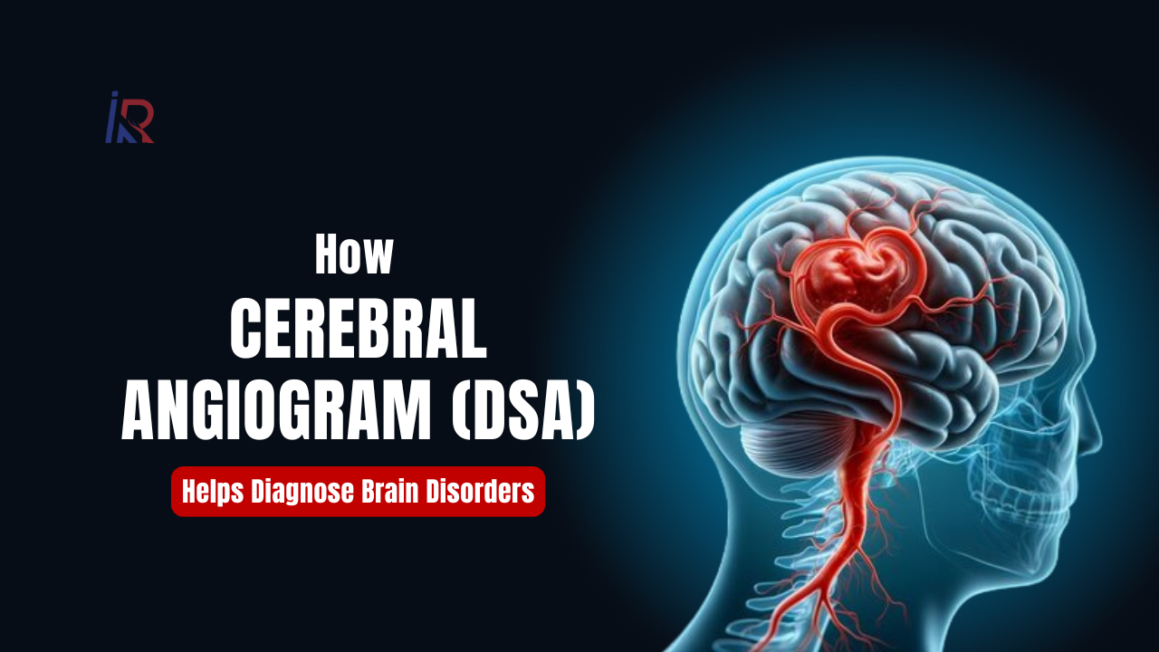 How a Cerebral Angiogram Helps Diagnose Brain Disorders