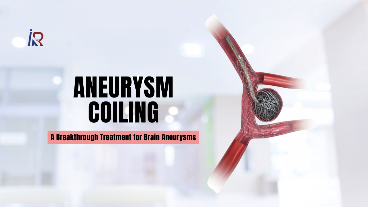 Aneurysm Coiling: Breakthrough Treatment for Brain Aneurysms