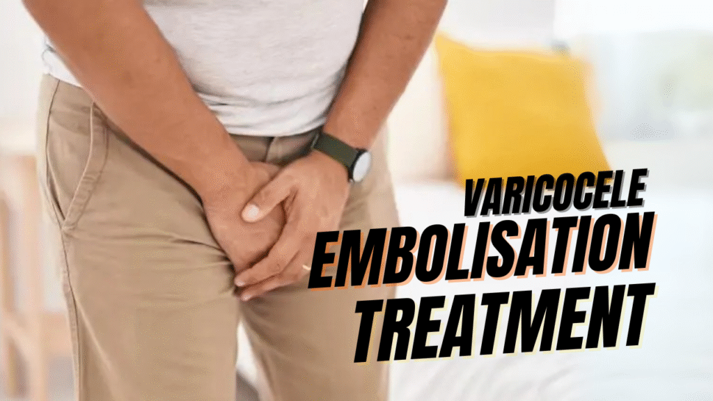 Varicocele Embolisation Treatment in Indore: The Best Minimally ...