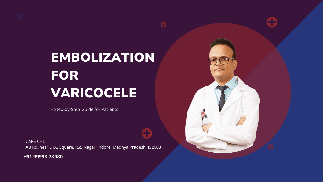 Embolization for Varicocele: Step-by-Step Guide for Patients